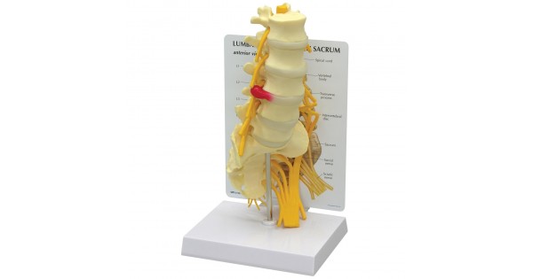 Lumbale Wervels met Heiligbeen