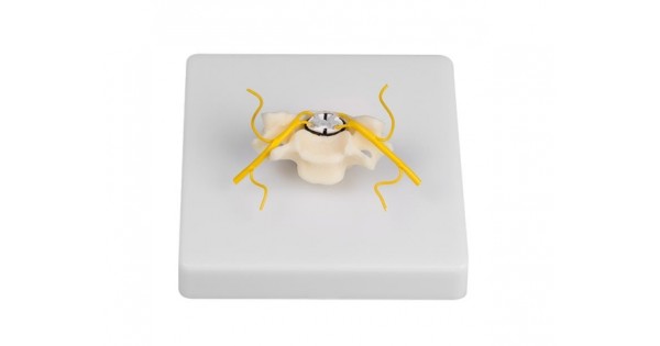 Wervel Model met Doorsnede Ruggenmerg