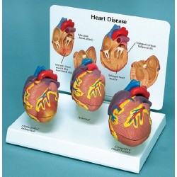 Anatomisch Model Hart