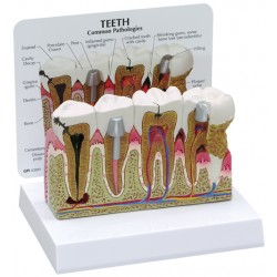 Anatomisch Model van het Gebit en de Tanden