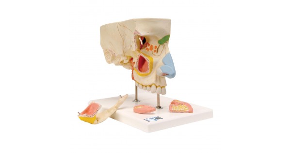 Neus met bijholten van de neus, 5 delig