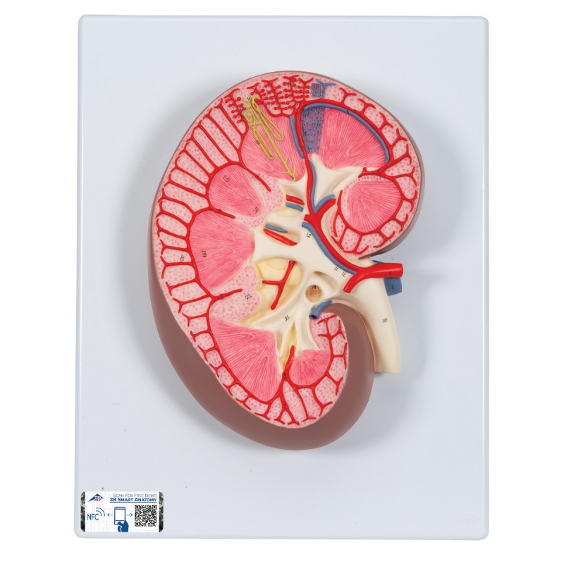 anatomisch nier model, doosnede